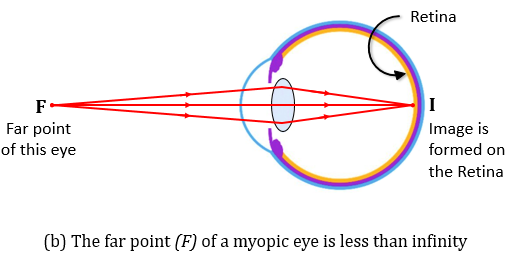 A Person Cannot See The Distant Objects Clearly Th Tutorix a-person-cannot-see-the-distant-objects-clearly-th-tutorix